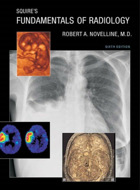 Novelline, Robert A. "Squire`s fundamentals of radiology, 6 ed."