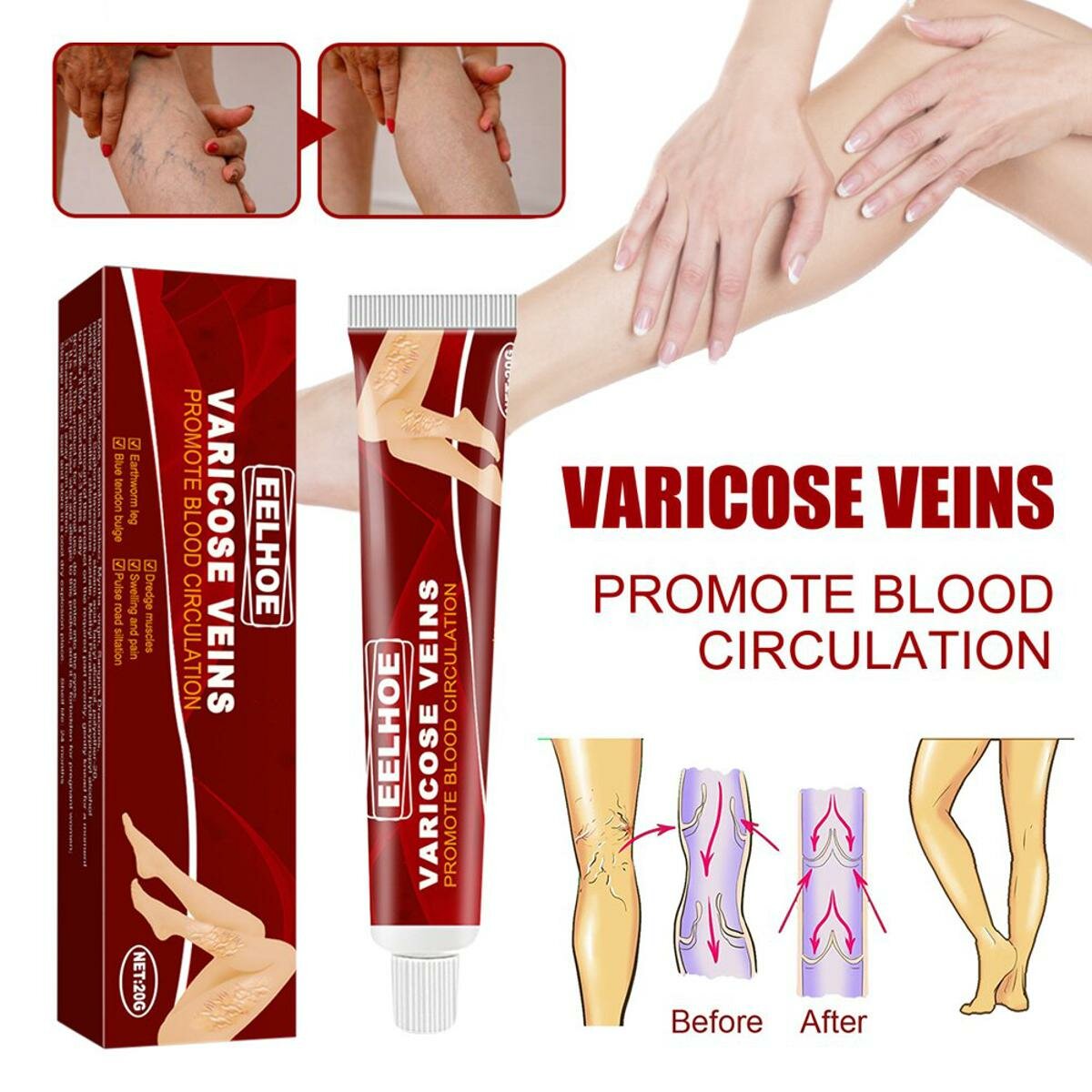 20 г крем для лечения варикозного расширения вен на ногах, васкулит, флебит, паук, обезболивающая мазь, пластырь для анг