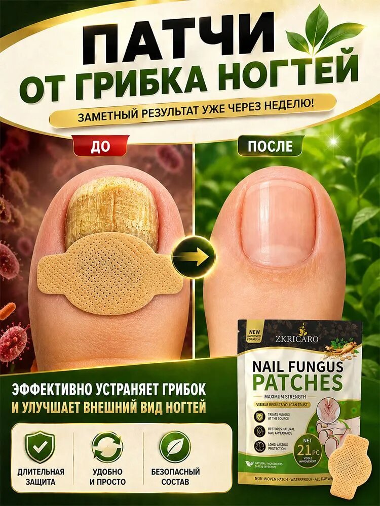 Пластыри для ухода за ногтями при онихомикозе, повреждениях и пожелтении, способствующие улучшению состояния ногтевой пластины