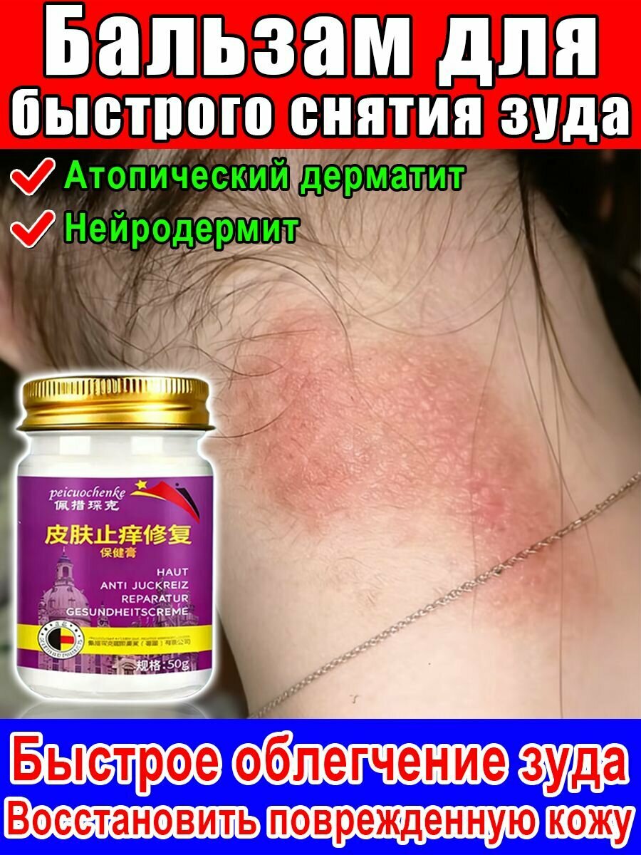 Мазь от нейродермита и дерматита