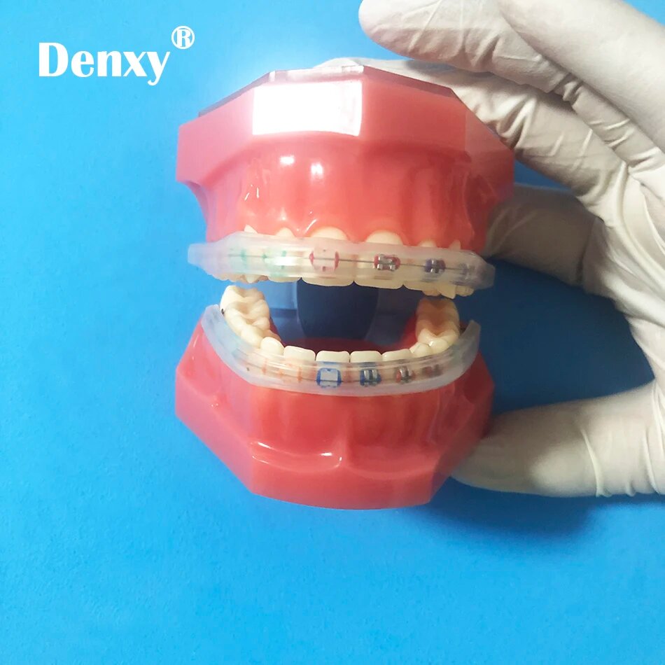 3 пакета ортодонтические брекеты, защита для рта, удобные бамперы для губ, комфортный щиток для губ, капа для ортодонтического брекета