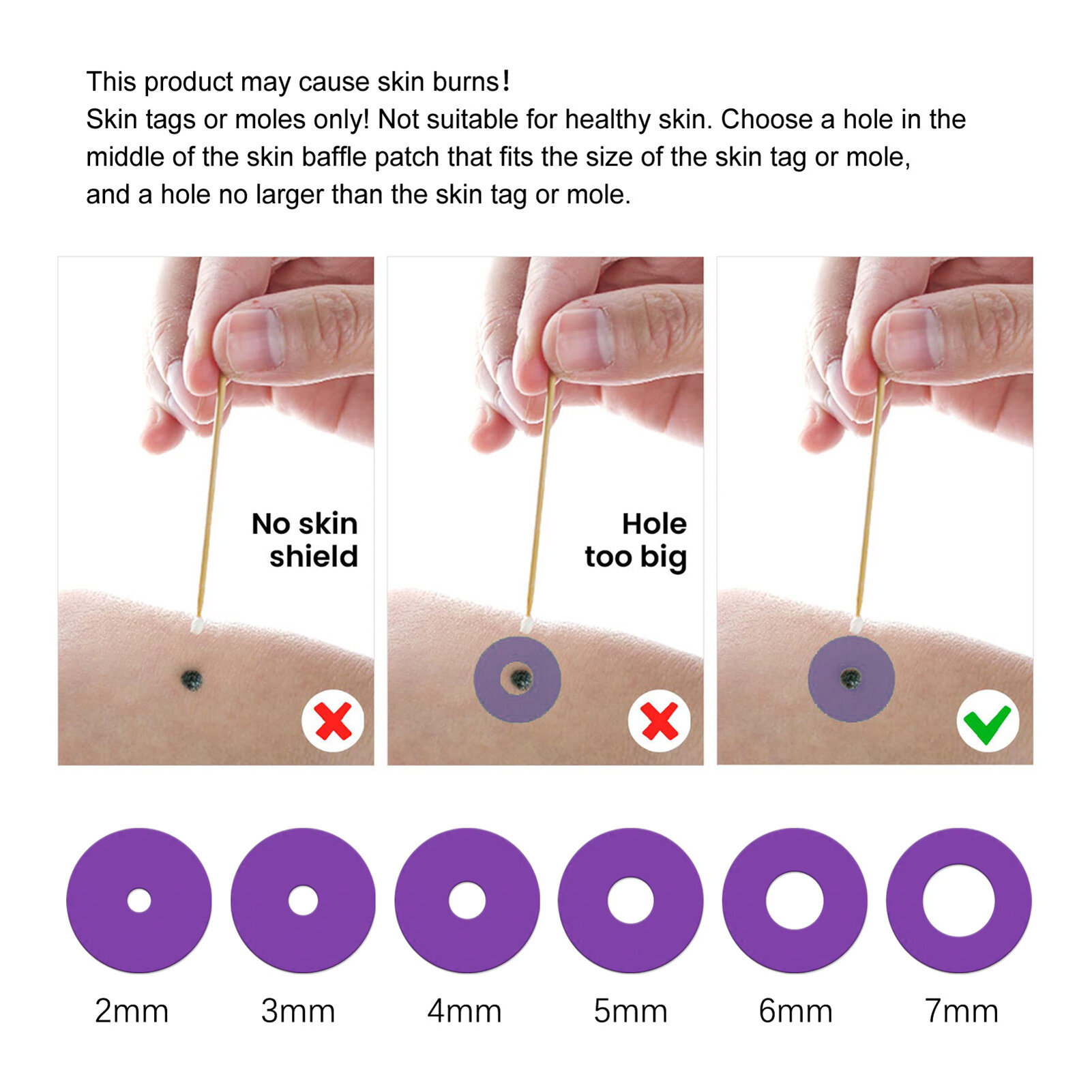 Жидкость для удаления бородавок Jaysuing, крем для удаления бородавок, щипцов, наростов на коже лица и шеи, подмышечных впадин, остроконечных папиллом
