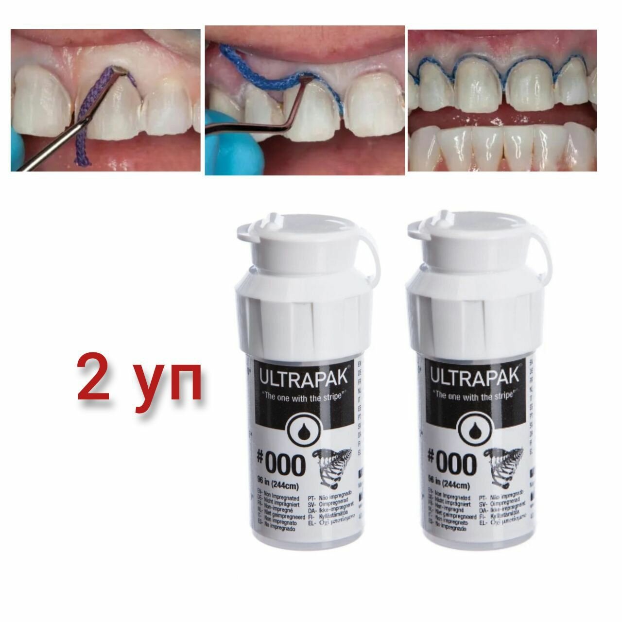 Набор 2 уп , нить ретракционная ULTRAPAK (ультрапак) #000 (244 см) Десневая Стоматологическая. №000 (черная)