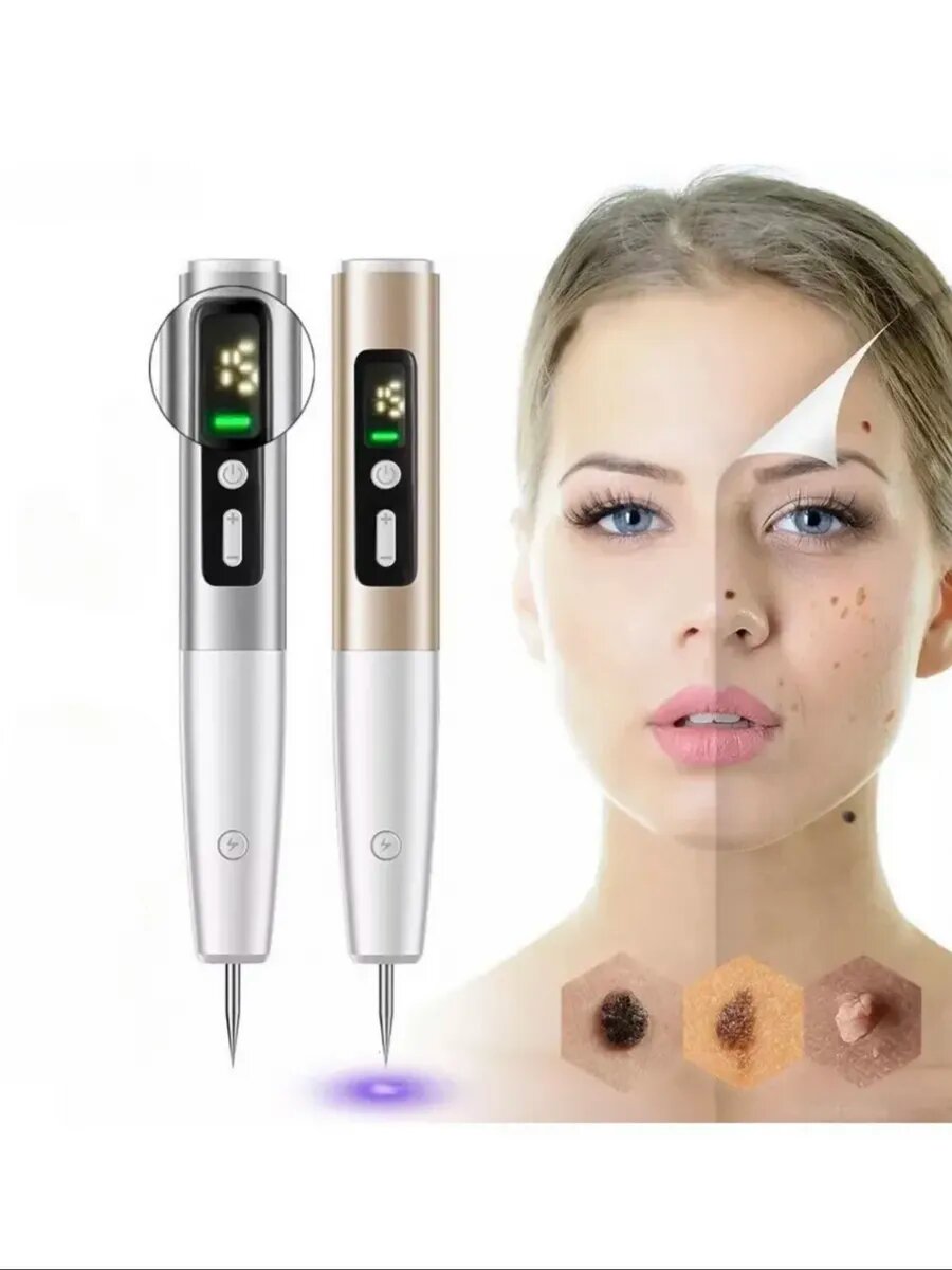 Косметический аппарат для удаления папиллом и бородавок