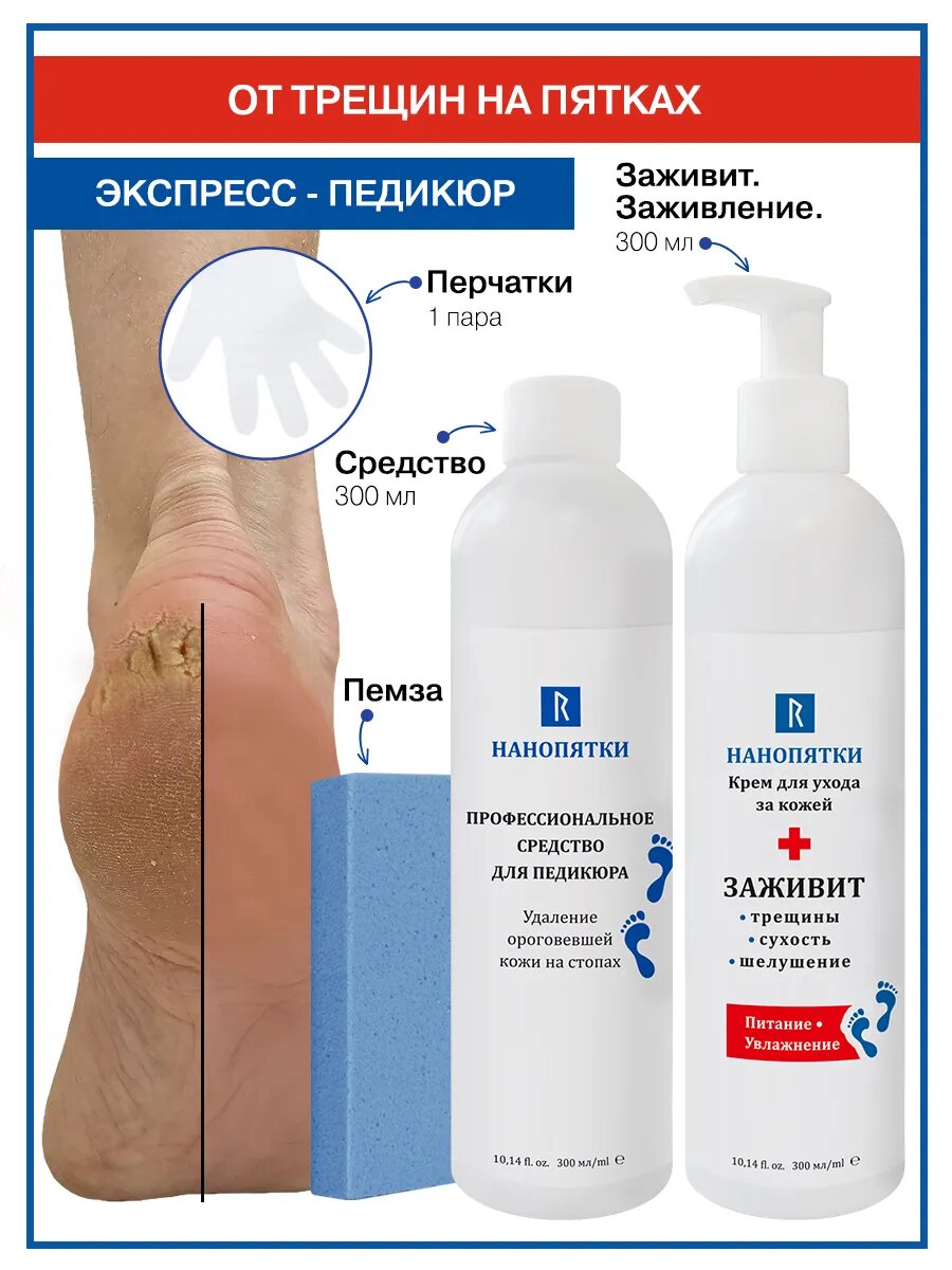 От трещин на пятках