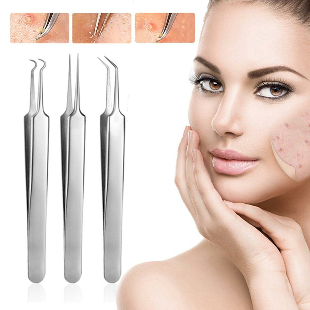 Инструменты для удаления черных точек Пинцет из нержавеющей стали для удаления черных точек, прыщей, угрей, черных точек, комедонов
