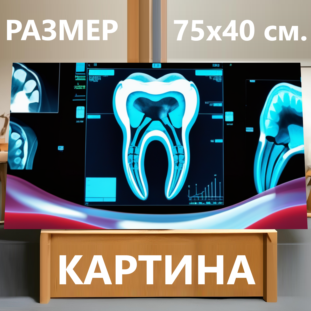 Картина на холсте "Клинические исследования рентгена в стоматологии" на подрамнике 75х40 см. для интерьера
