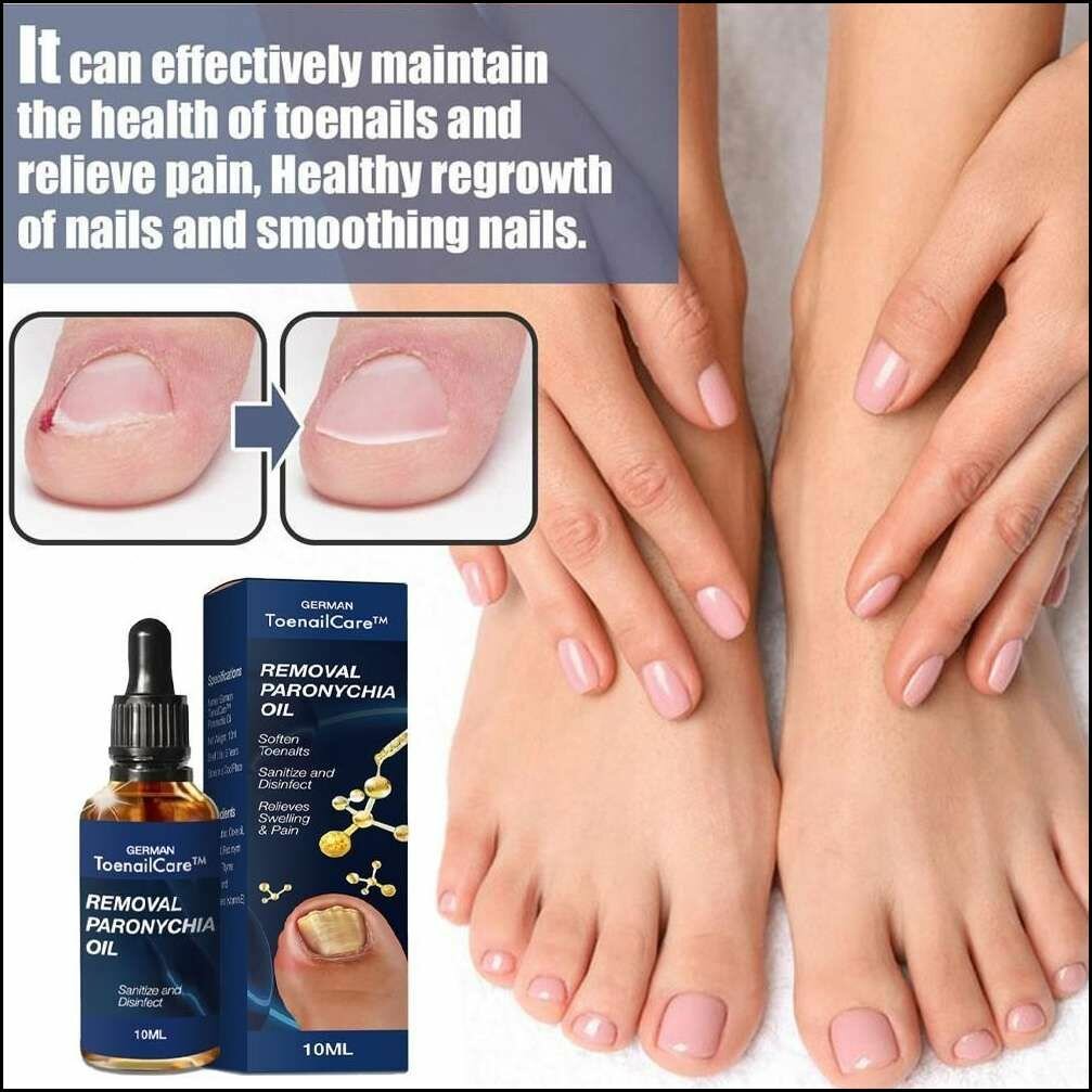 Масло для удаления паронихии от вросших ногтей, уход за ногтями, новинка 2025 года11