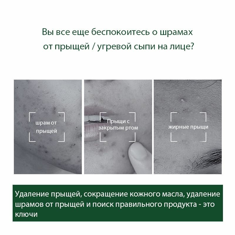 Сыворотка для лица — фото 1