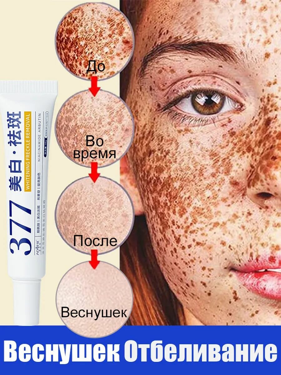 Крем против пигментных пятен и веснушек, с Витаминами С и Е, и Гиалуроновой кислотой, Средство против пигментации, осветляющий и увлажняющий,30 г