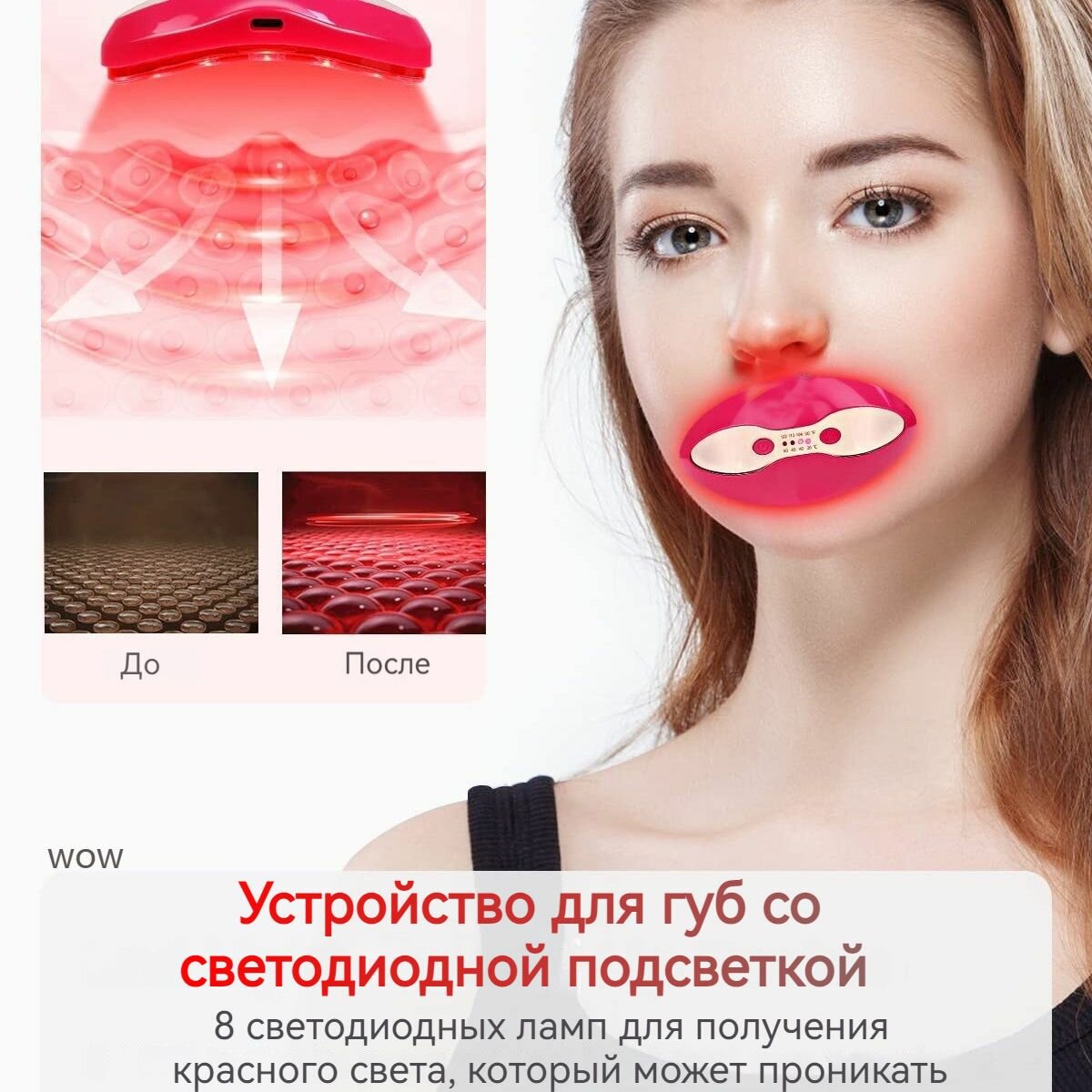 Фототерапия