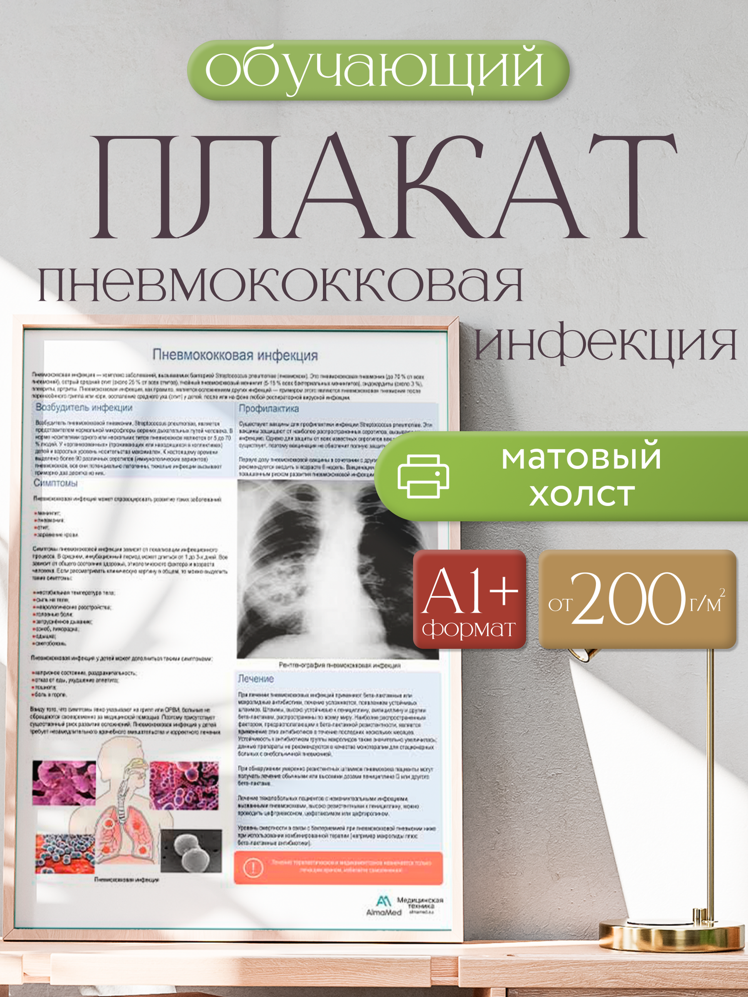 Пневмококковая инфекция медицинский плакат матовый холст от 200 г/кв. м, размер A1+