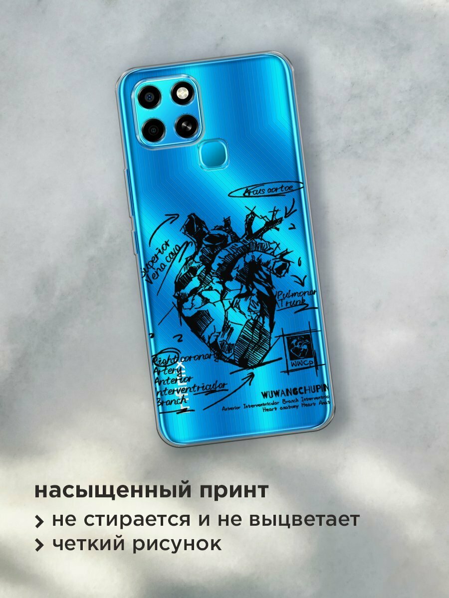 Чехол на Infinix Smart 6 / Инфиникс Смарт 6 с принтом "Анатомическое сердце 2", прозрачный — фото 1