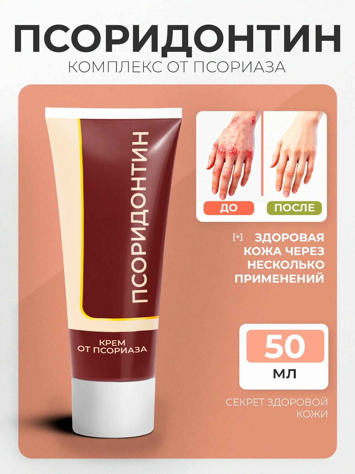 Псоридонтин: крем от псориаза и дерматита, восстанавливающий эффект, 50 мл
