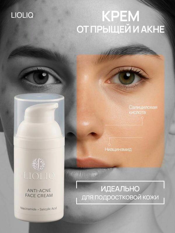 LIOLIQ - Крем от прыщей на лице и теле с салициловой кислотой