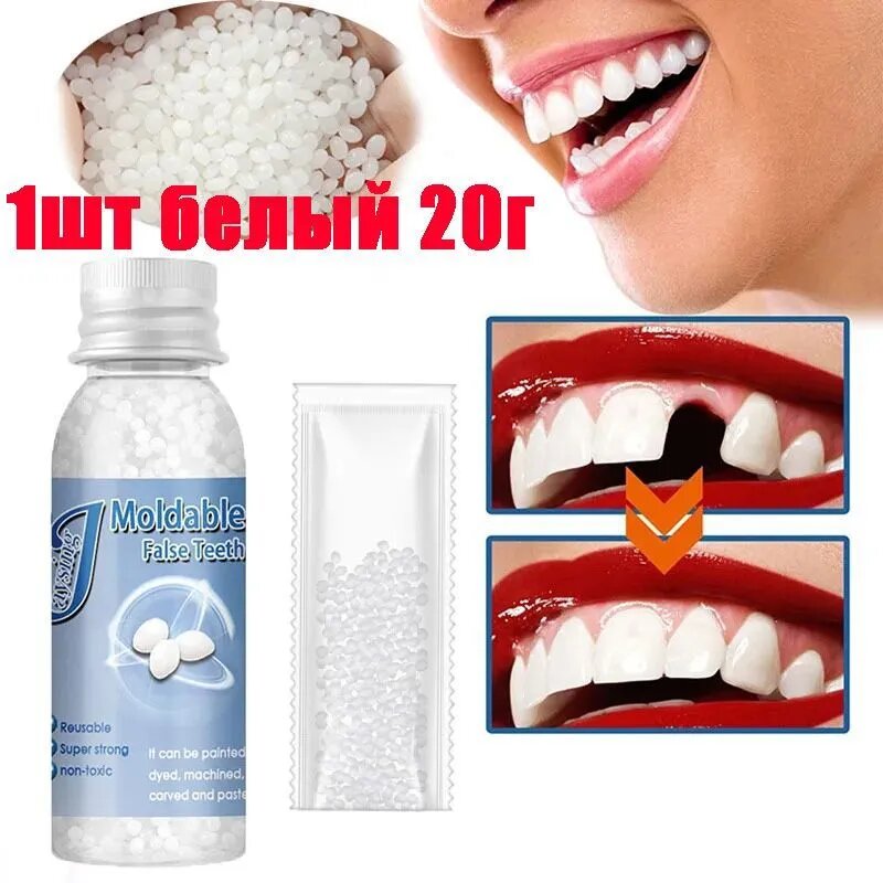 Реставрация зубов из смолы, клей для заполнения зазоров, расходные материалы для клея