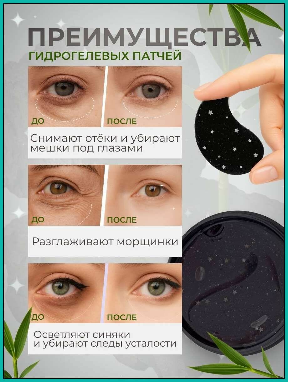 Патчи — фото 1