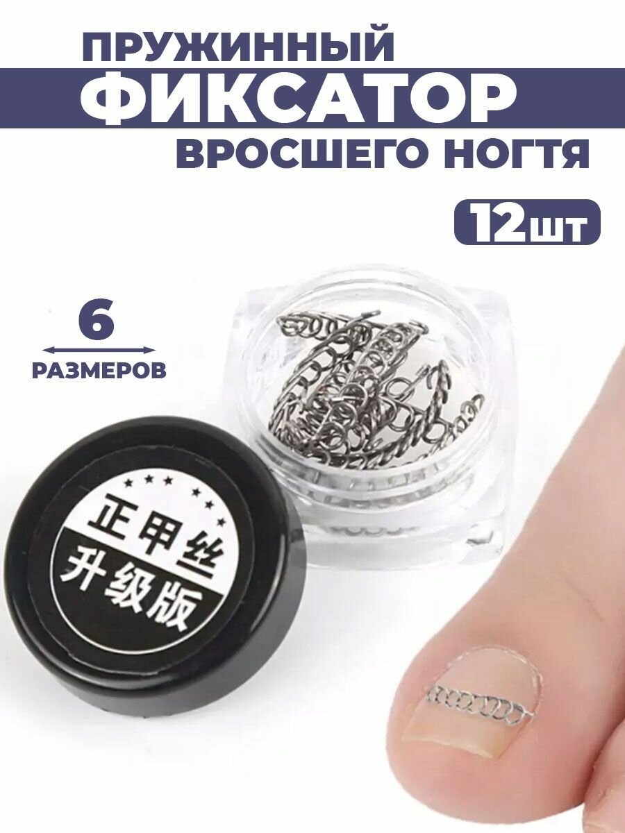 Корректор для вросшего ногтя скобы
