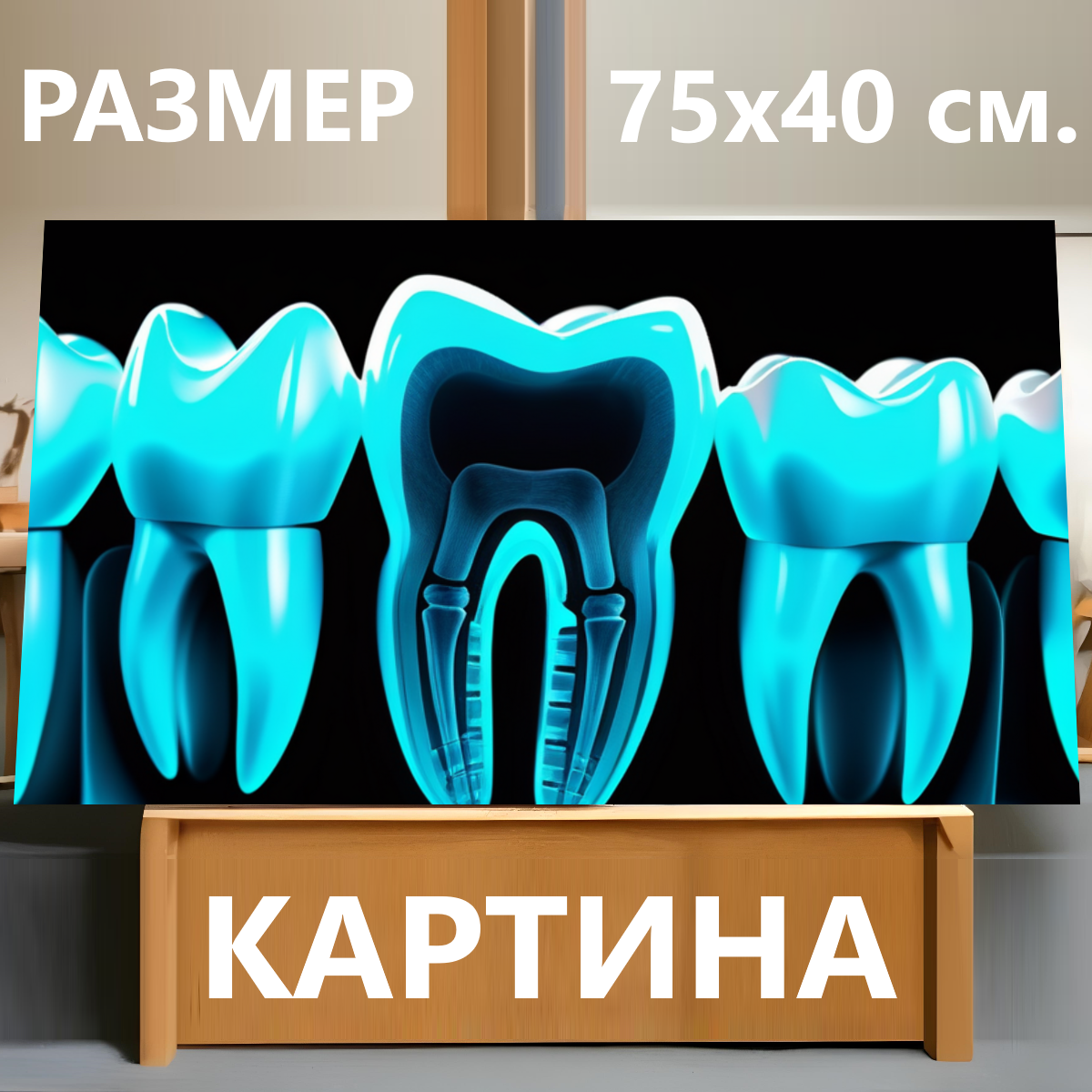 Картина на холсте "Стоматологический рентген зубов" на подрамнике 75х40 см. для интерьера