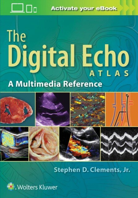 Clements Stephen D. "Digital echo atlas"