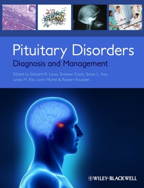 Laws "Pituitary Disorders: Diagnosis and Management"