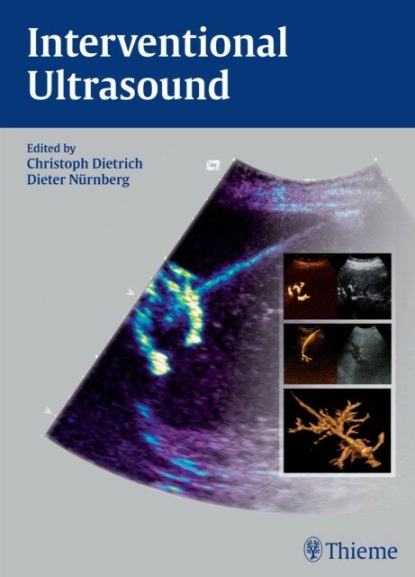 Christoph Frank Dietrich "Interventional Ultrasound: A Practical Guide and Atlas"