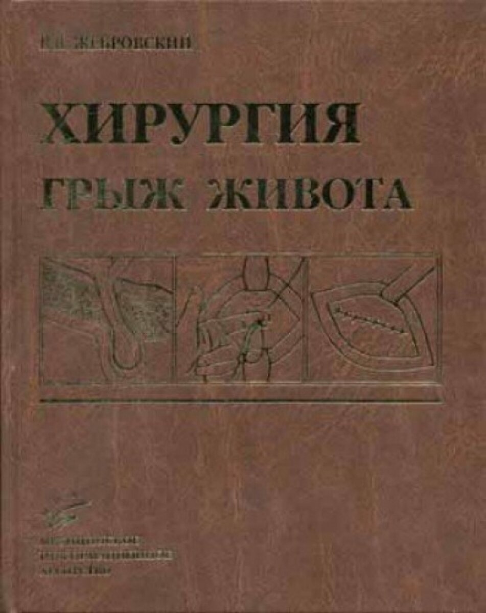 Хирургия грыж живота