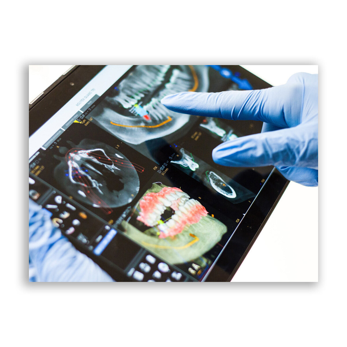 Постер, плакат на бумаге / Для стоматологии / Размер 40 x 53 см