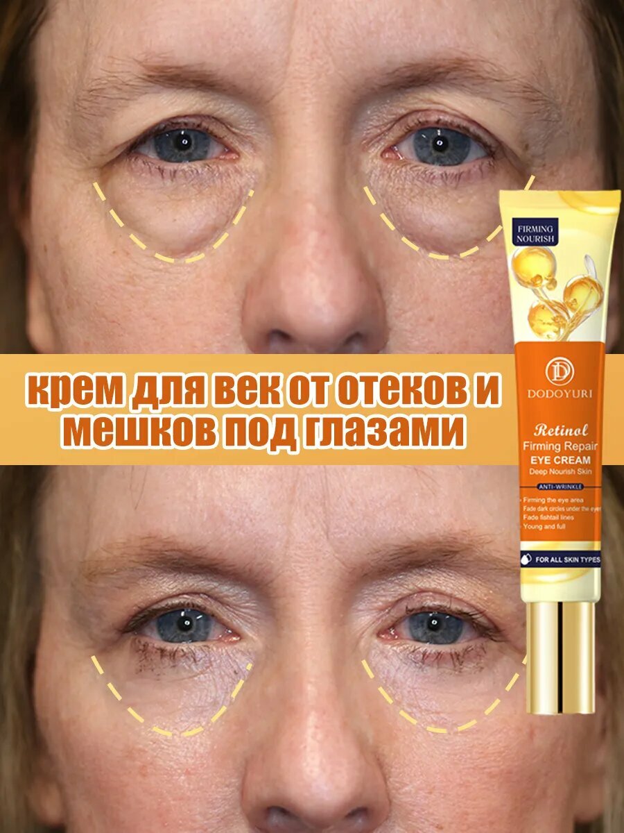 Противоотечный охлаждающий крем для век мгновенного действия, убирает мешки под глазами и следы усталости, уход за кожей