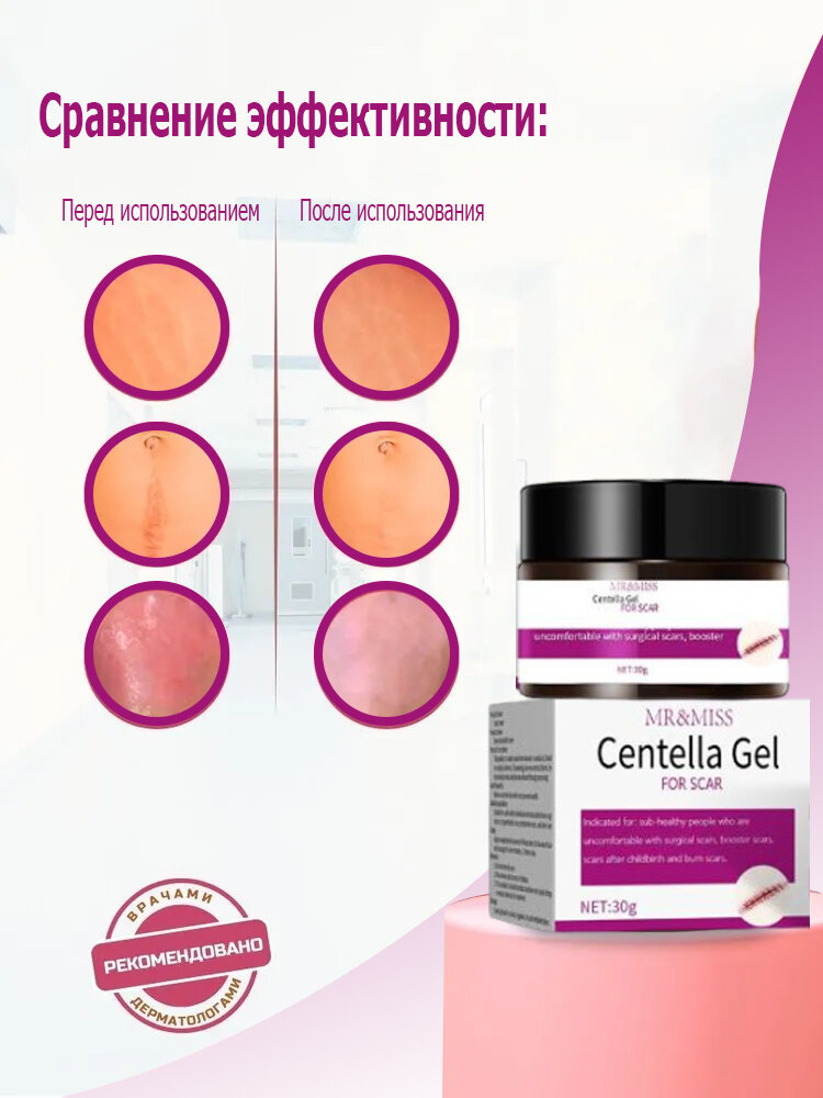 Крем MR&MISS, от растяжек при беременности, для восстановления кожи, 30г