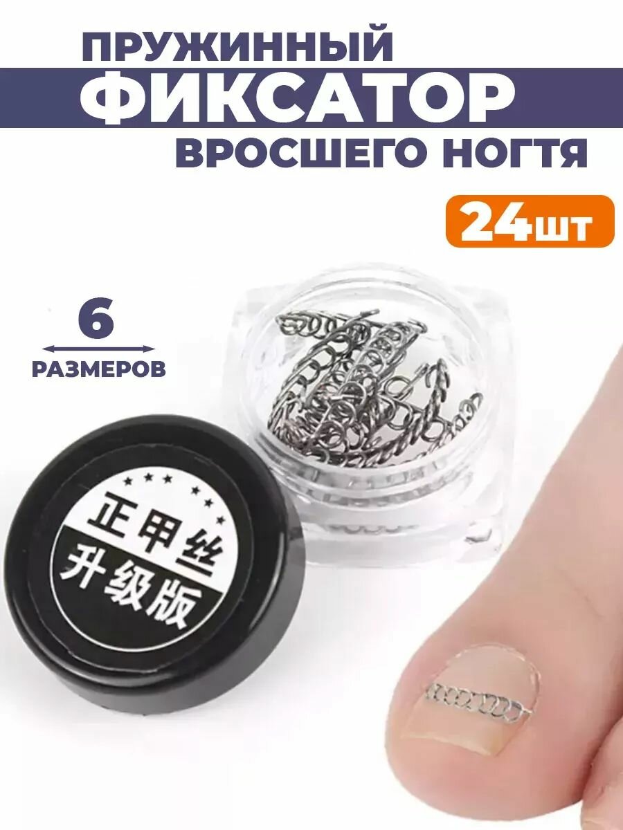 Корректор фиксатор для вросшего ногтя