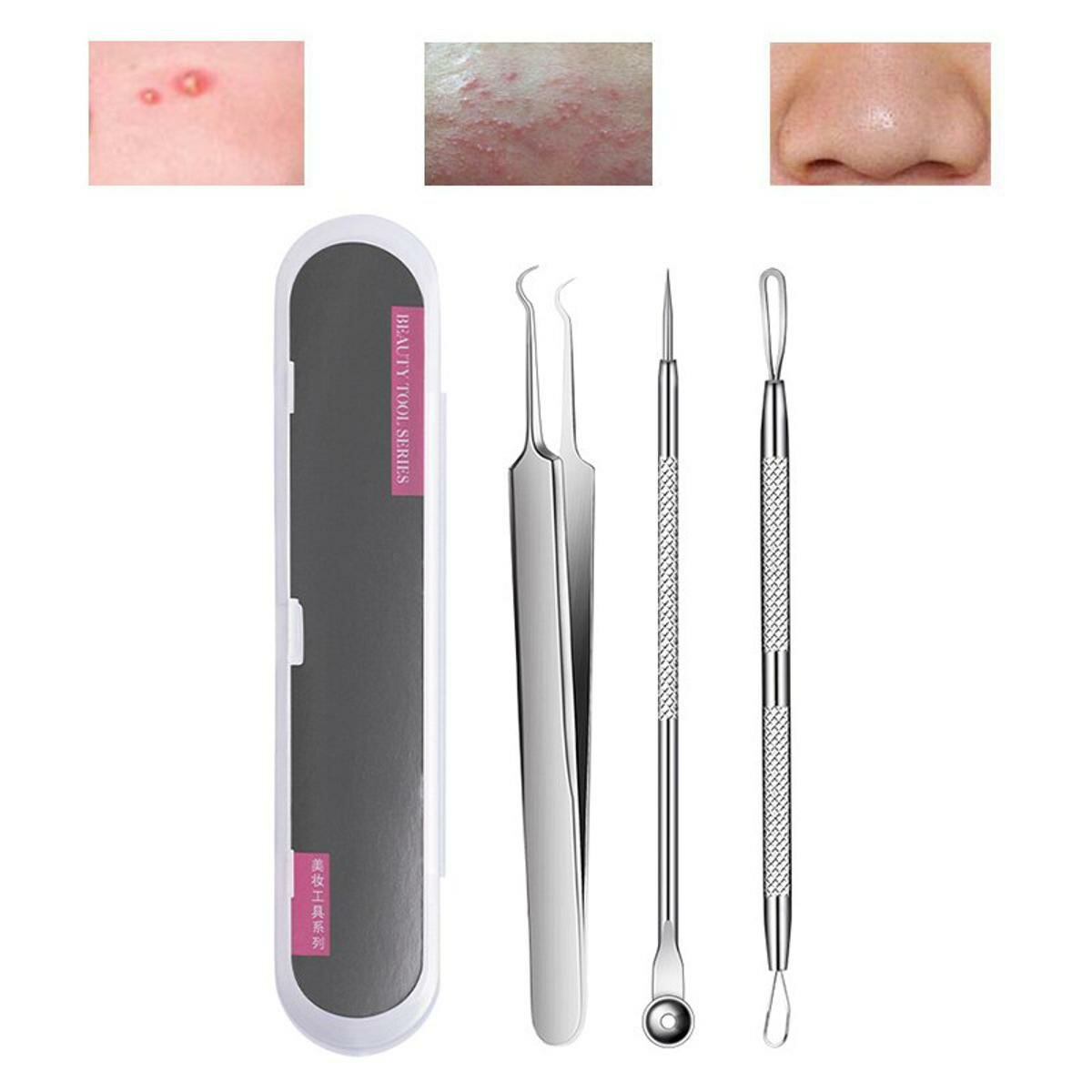3/4/5/7 шт. иглы для удаления угрей и комедонов для выдавливания акне, прыщей, экстрактора пятен, очистителя пор для лица, инструменты для ухода за кожей