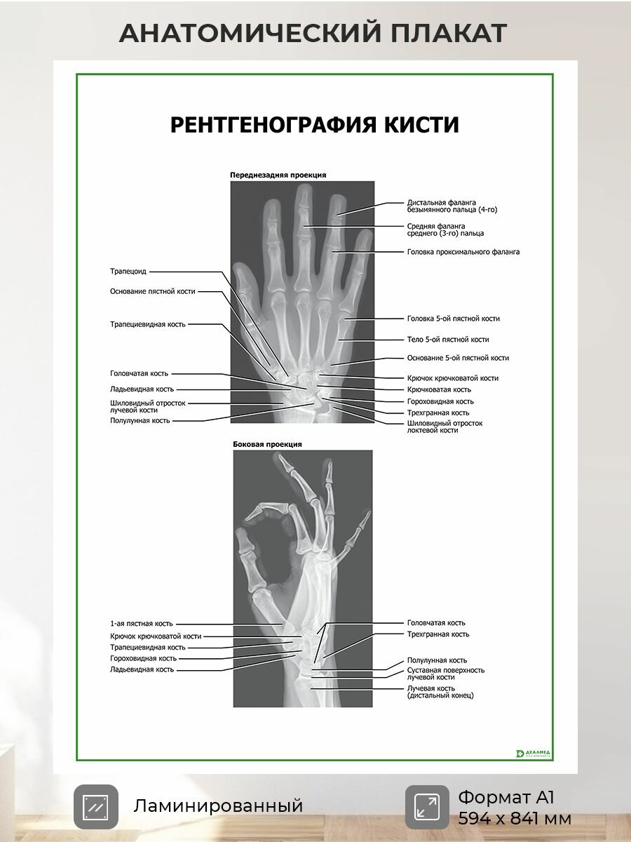 Обучающий медицинский плакат ламинированный формат А1 Рентгенография кисти