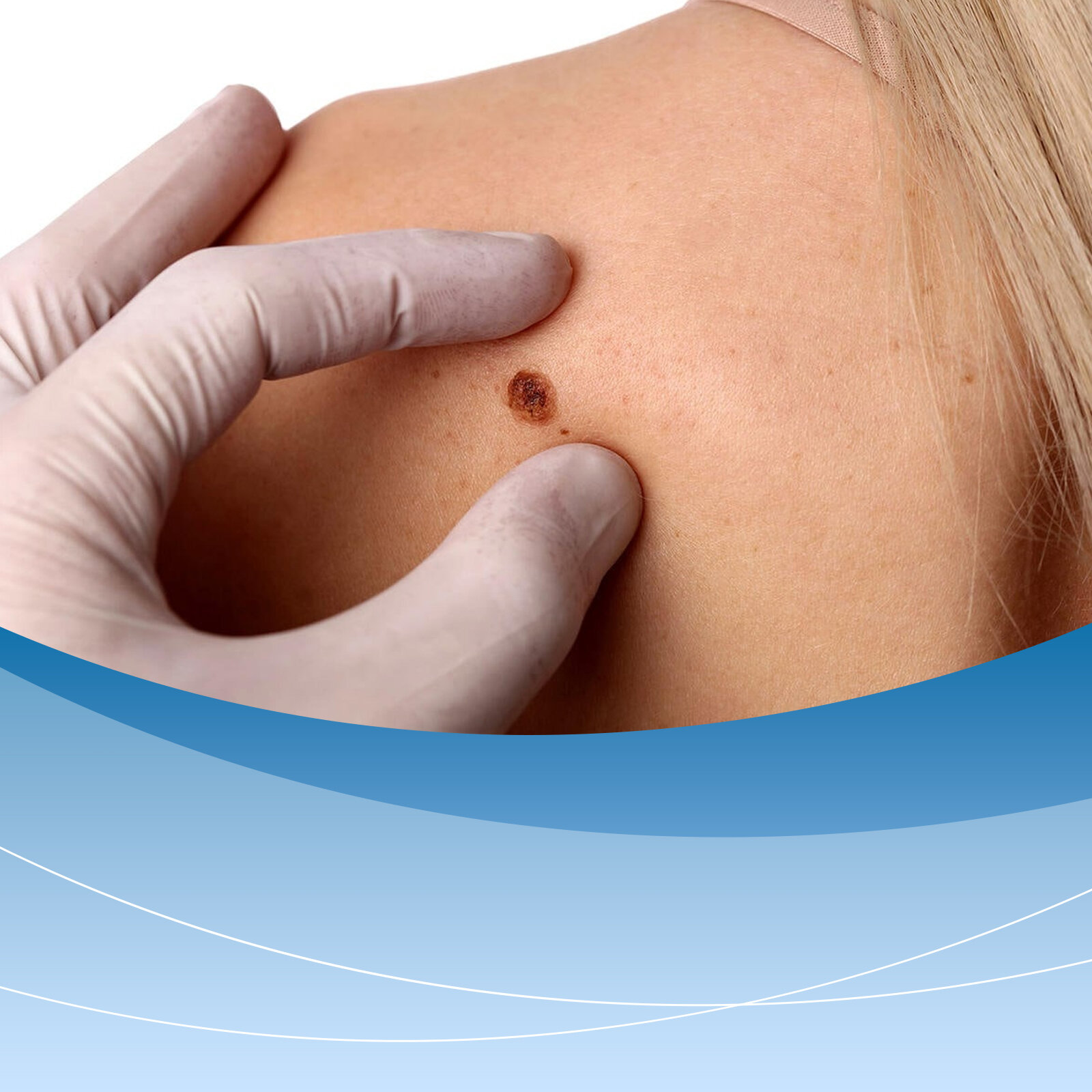 Патчи Для Ухода За кожей Нежные Питательные Очищающие Патчи Для Ухода За Гладкой Кожей Тела