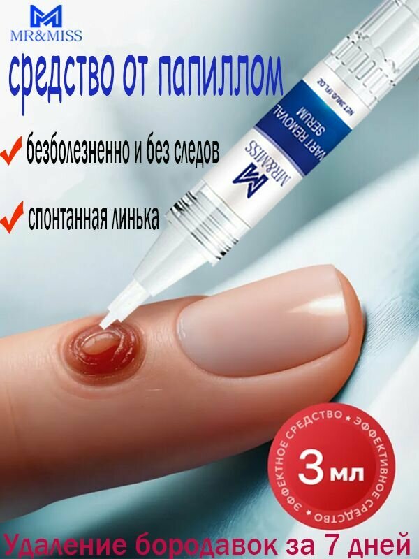 Карандаши для удаления бородавок MR&MISS для лечения бородавок, папиллом и родинок без боли и следов 3 мл