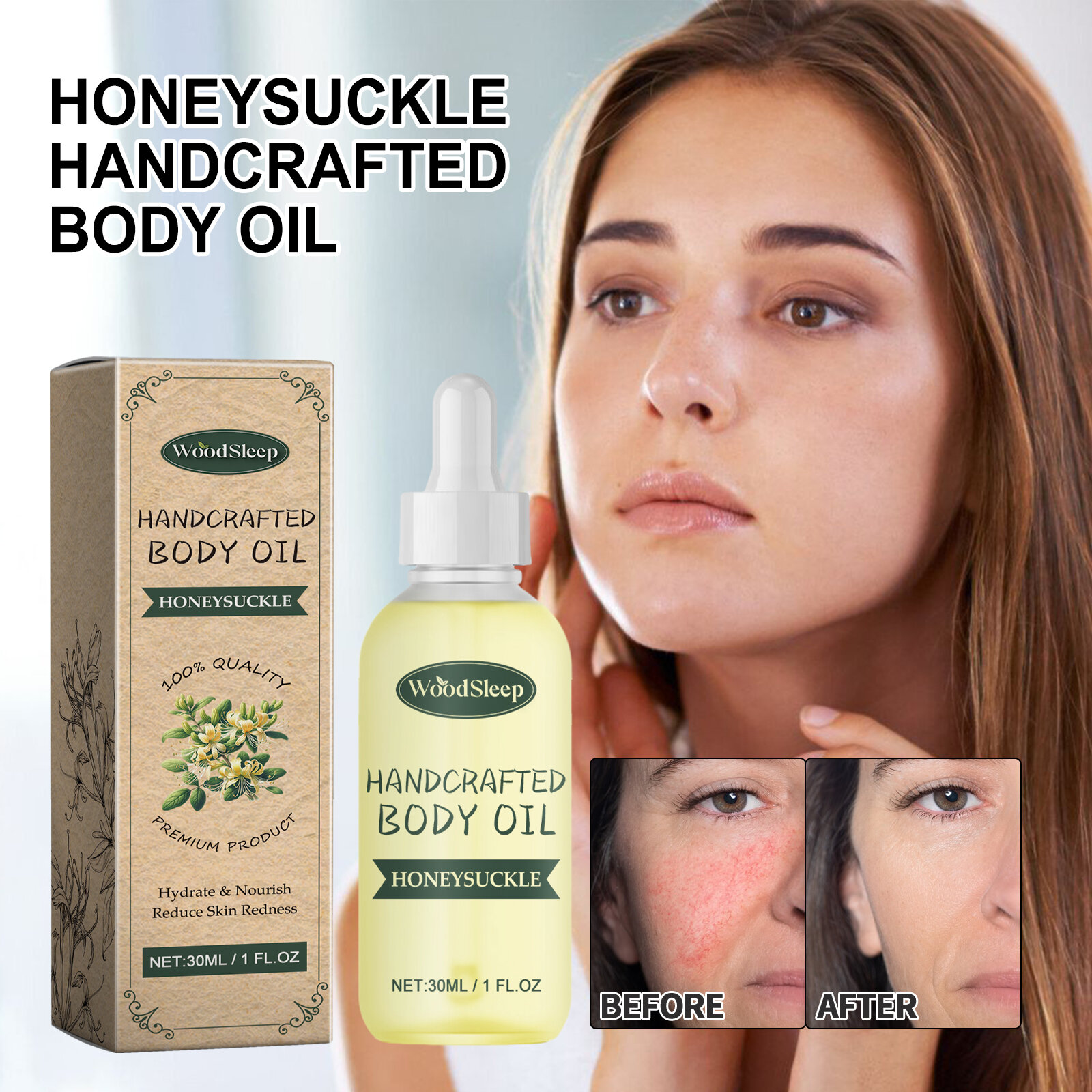 Эфирное масло лесной жимолости для ухода за кожей Устраняет покраснения лица и уменьшает шрамы Универсальное эфирное масло для тела