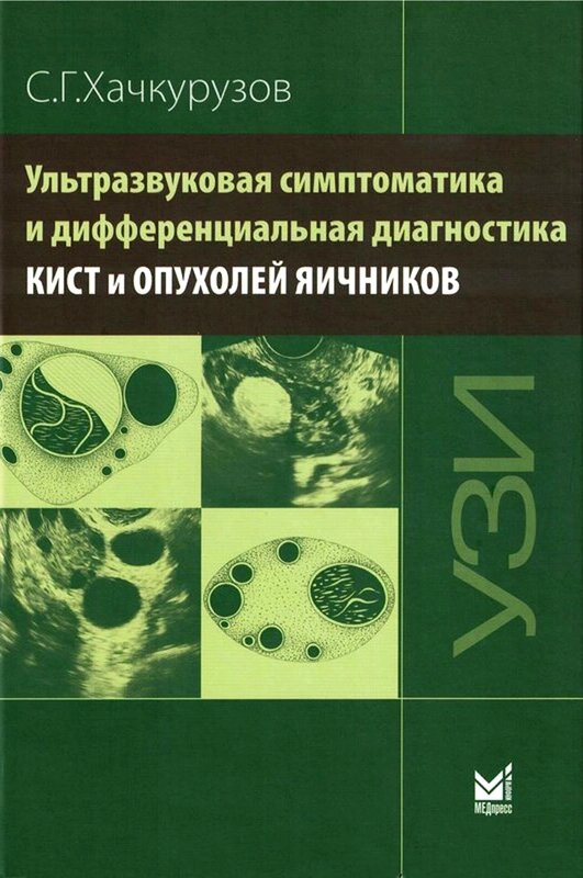 Ультразвуковая симптоматика и дифференциальная диагностика кист и опухолей яичников. 2-. (Хачкурузов С. Г.)