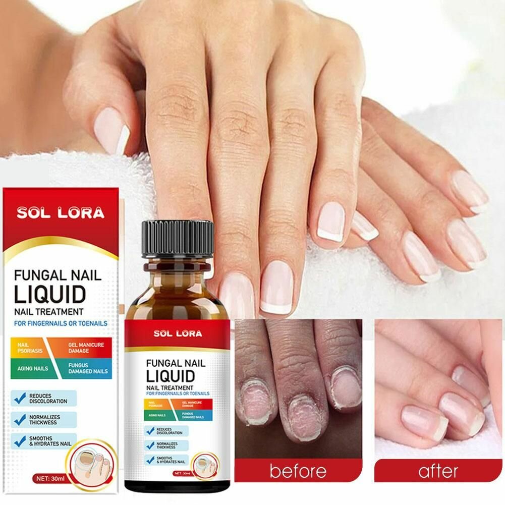 Мазь от грибка ногтей, Против выпадения ногтей, подходит для лечения грибковой паронихии,30ML