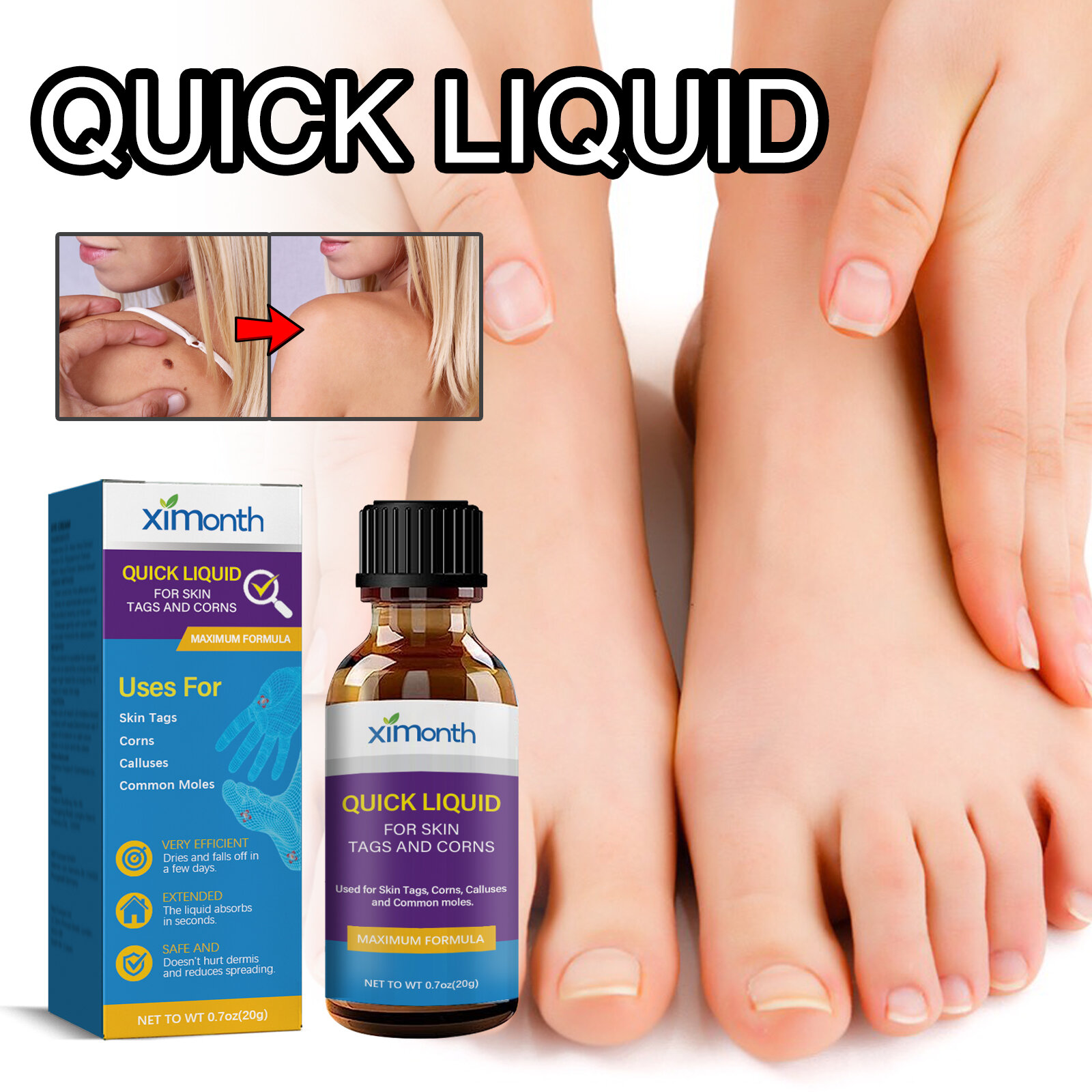 Жидкость от бородавок для рук и ног, от бородавок, натоптышей, родинок, кожных меток, шипов, гладкой кожи, очищение и уход