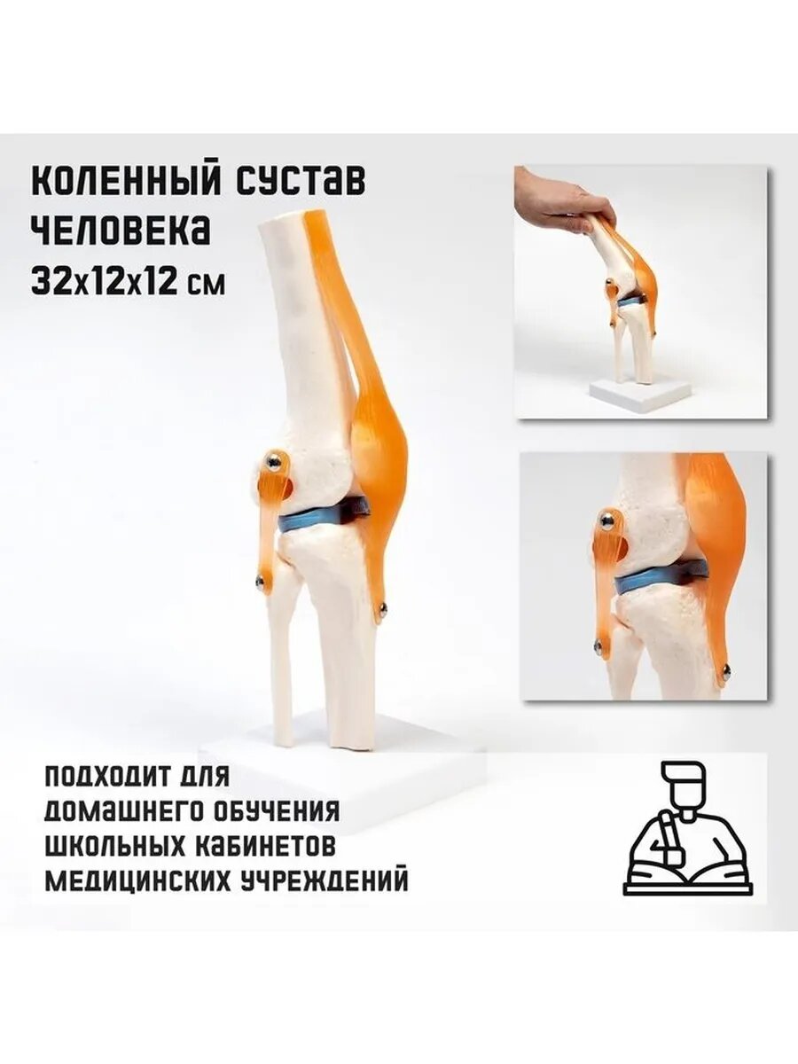 Макет "Коленный сустав", 32*12*12см