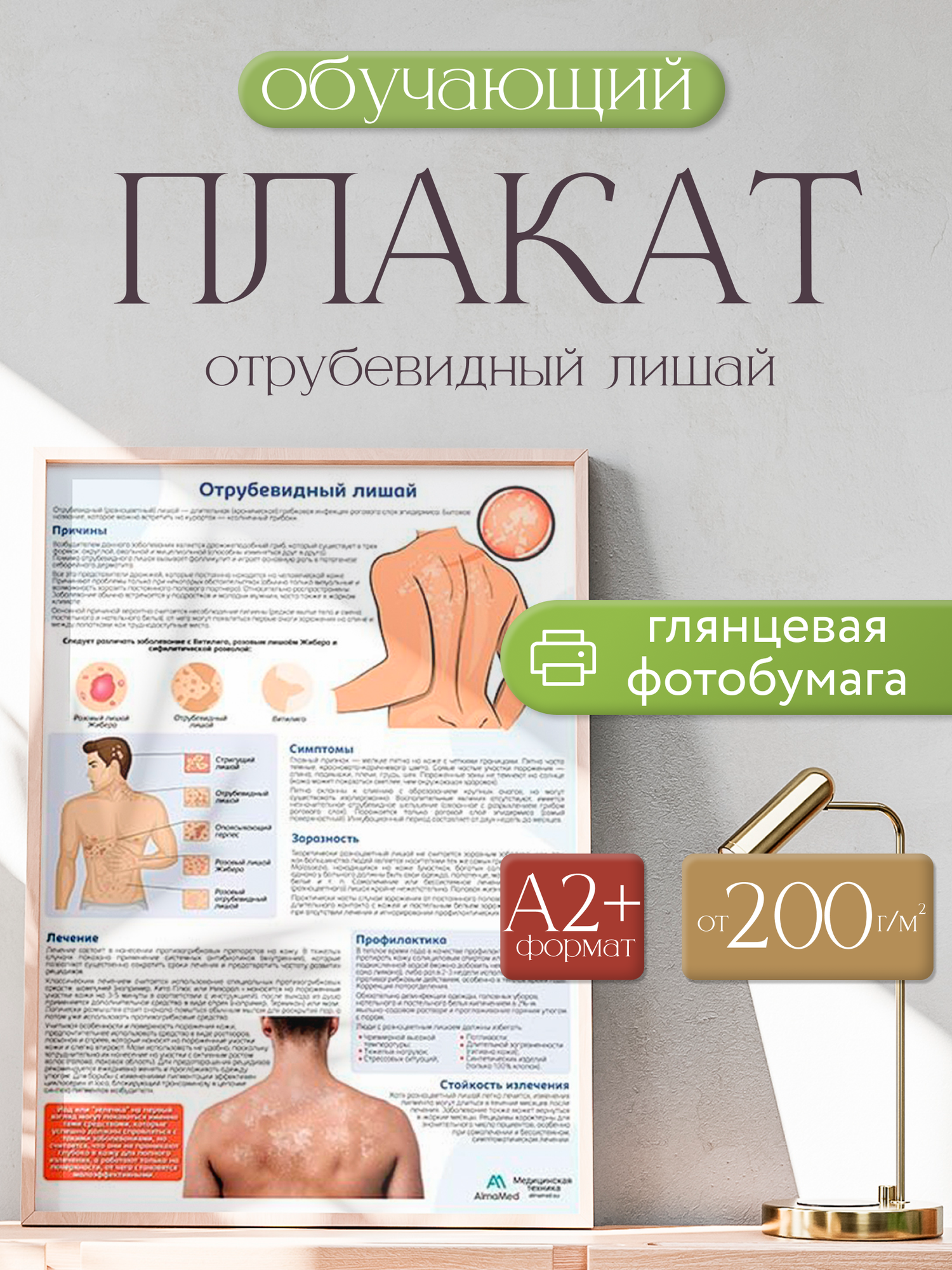 Отрубевидный лишай медицинский плакат, глянцевая фотобумага от 200 г/кв. м, размер A2+
