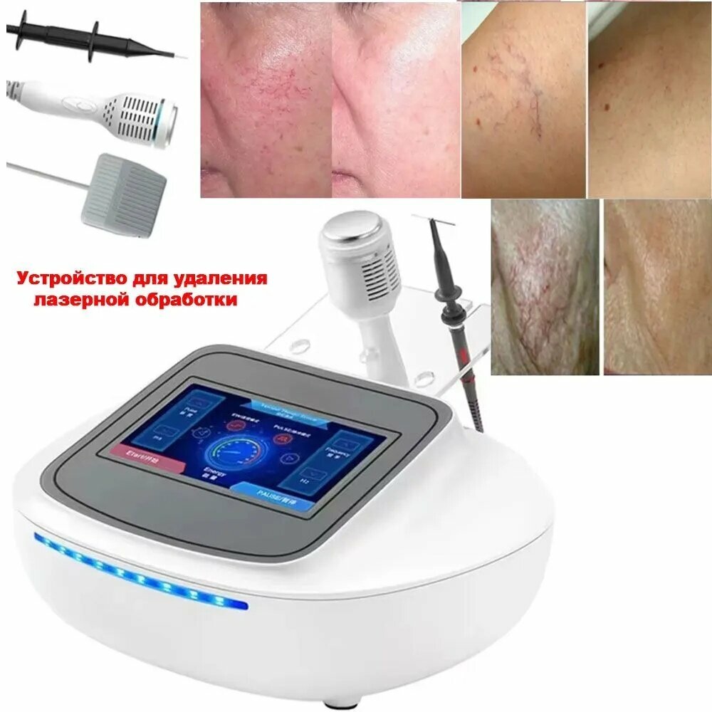 Устройство для лазерного лечения/покрасневших вен/варикозного расширения вен