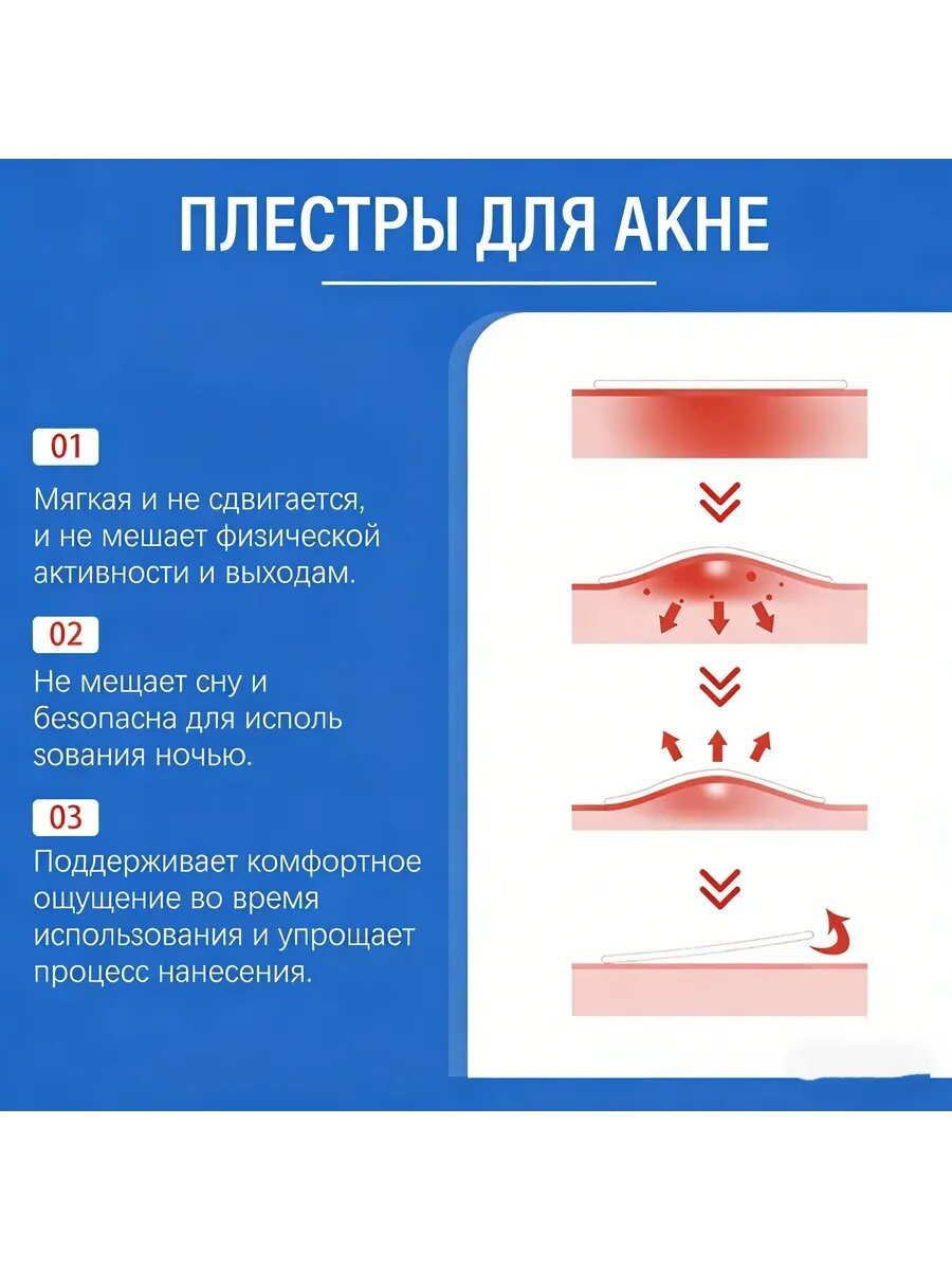 Пластырь от прыщей: мягкий уход за кожей лица, ежедневное маскирование высыпаний, удобный для ношения с собой, 432 шт — фото 1