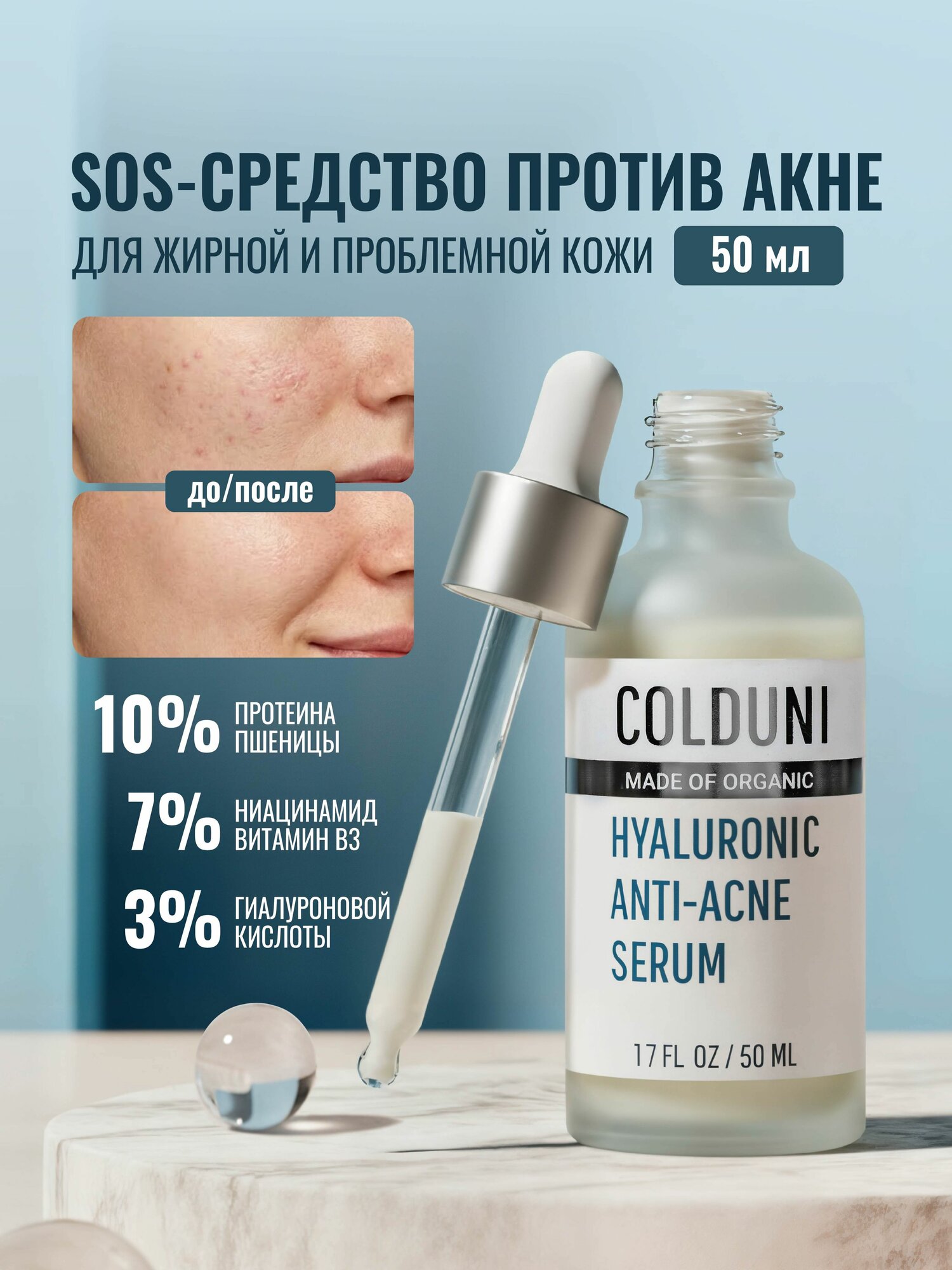 Сыворотка для лица и тела с ниацинамидом и гиалуроновой кислотой от прыщей и акне Colduni (Колдуны), объем 50 мл