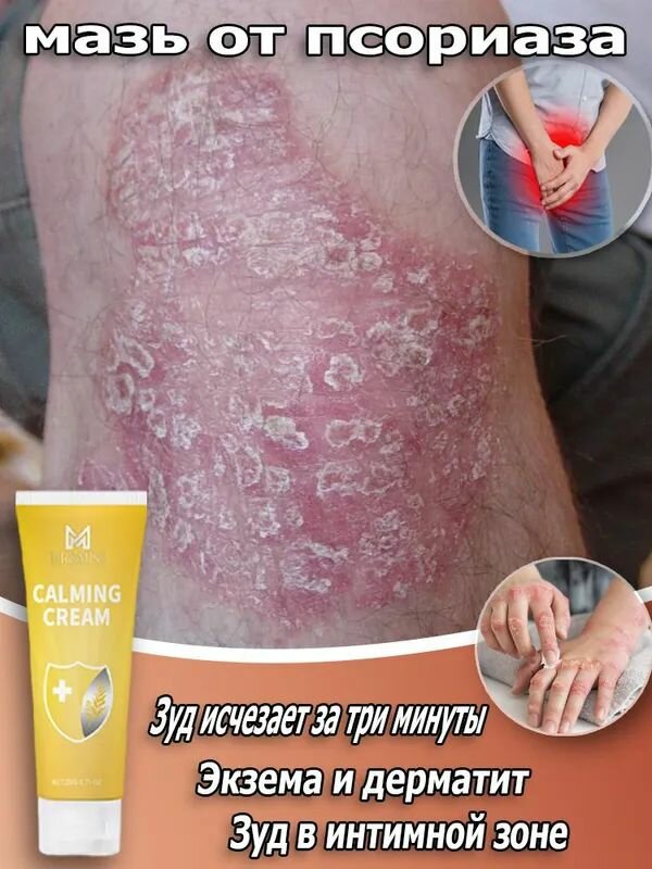 Мазь от псориаза, для лечения псориаза, дерматита и зуда, без раздражения, восстанавливает кожу, 20 г