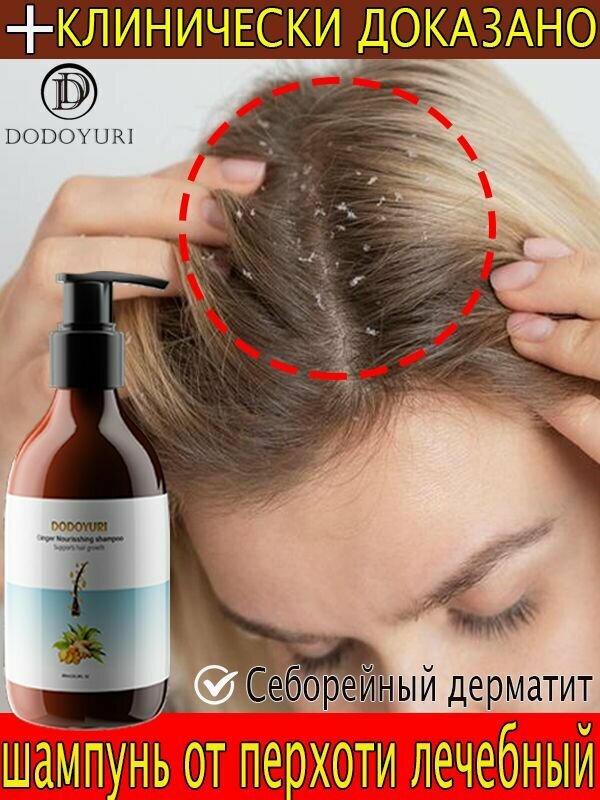 DODOYURI Интенсивный шампунь против перхоти, лечебный, от себореи, от псориаза, для нормальных и жирных волос, 300 мл