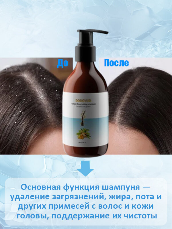 Шампунь против перхоти экстра-сильной действия, шампунь для лечения перхоти и себорейного дерматита, 300 мл