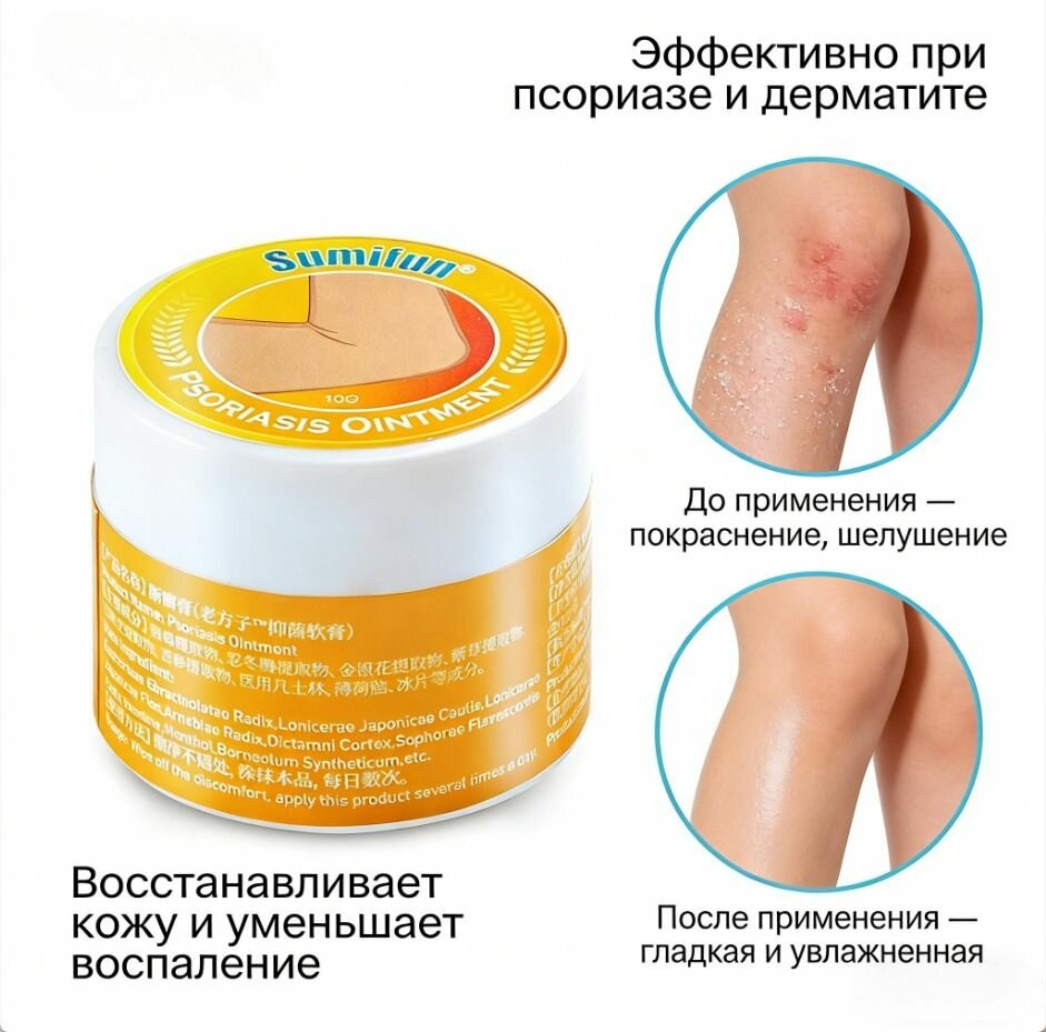 Sumifun PSORIASIS Ointment наружная лечебная мазь с натуральными травяными экстрактами