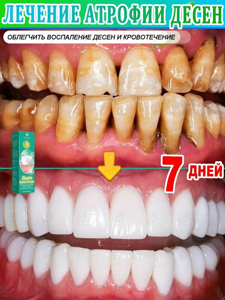 Эфирное масло для ухода за зубами. Быстро устраняет рецессию, покраснение и отёк дёсен, укрепляет корни зубов и снижает чувствительность зубов. Не раздражает слизистую оболочку полости рта. 30 мл.