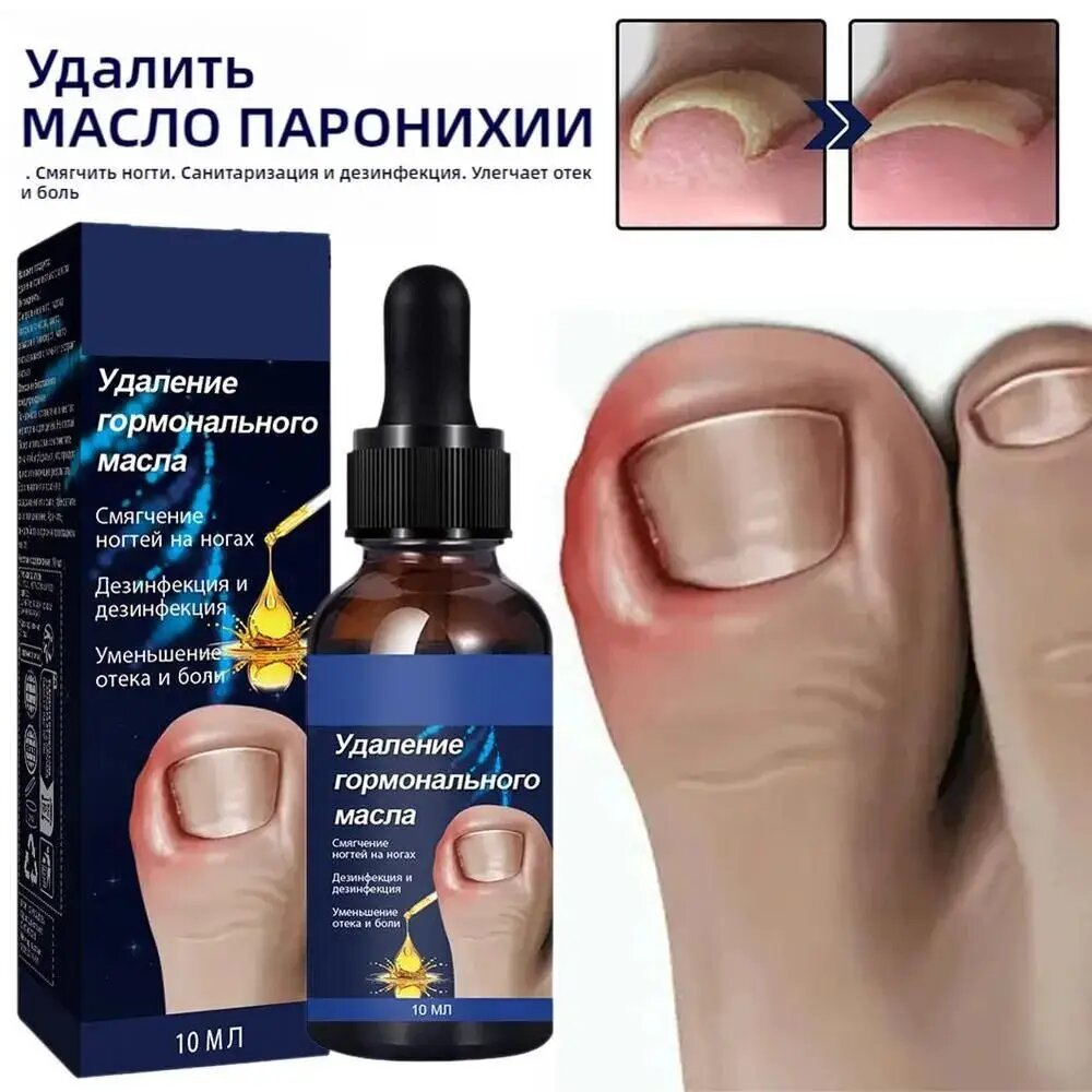 Качественный масляный уход от вросших ногтей для ног, паронихия удаляется